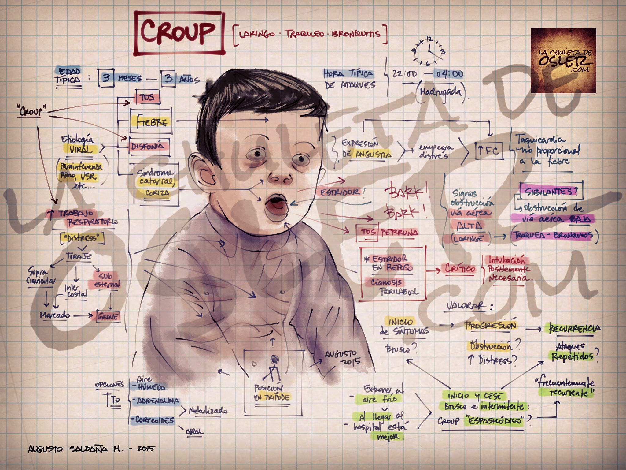 Pediatría – Croup (Laringitis) – La Chuleta de Osler
