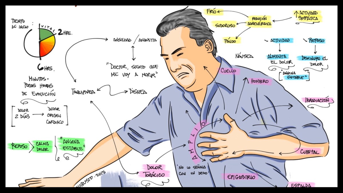 Cardiología: Dolor torácico típico (Angina)