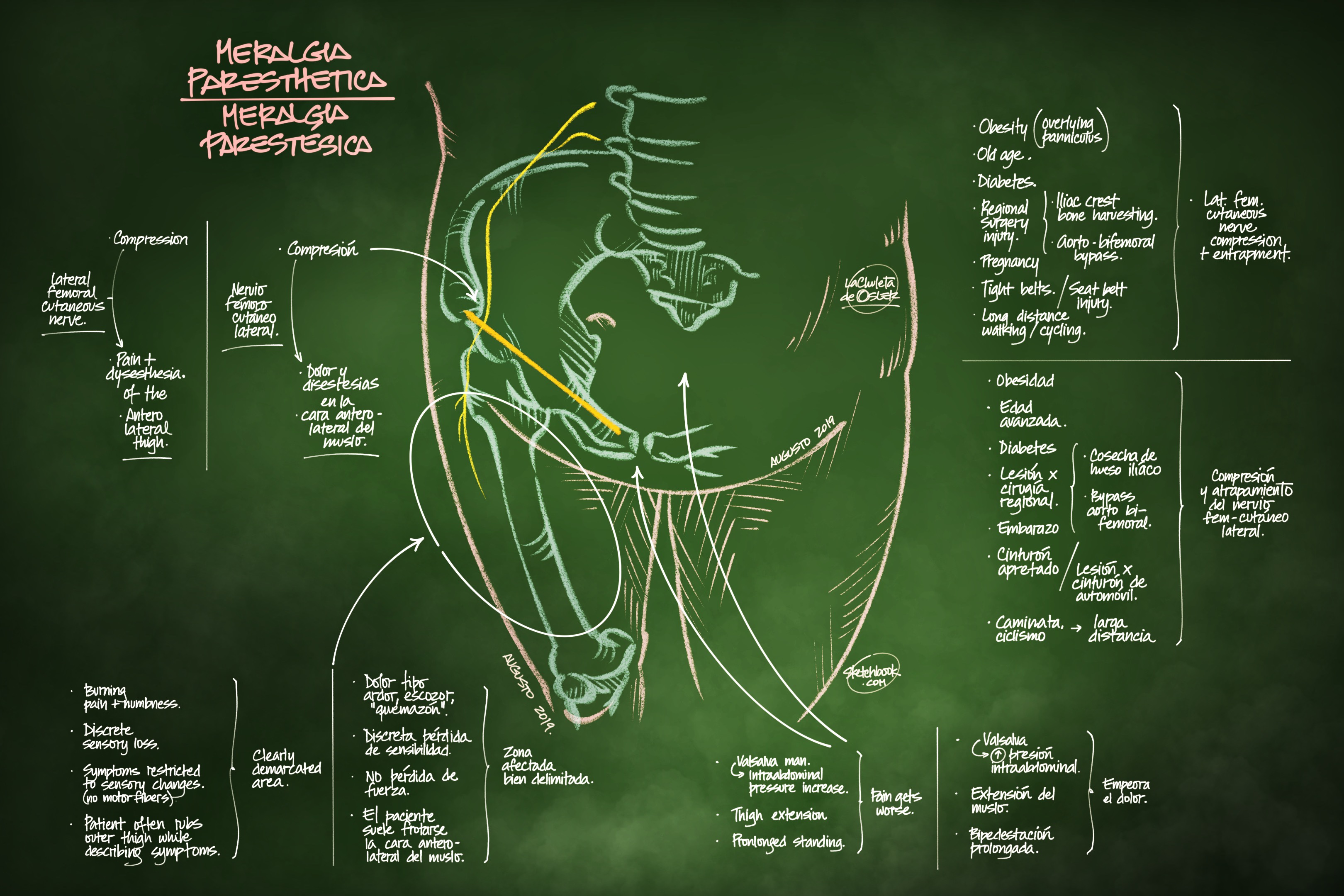 Meralgia parestésica – La Chuleta de Osler