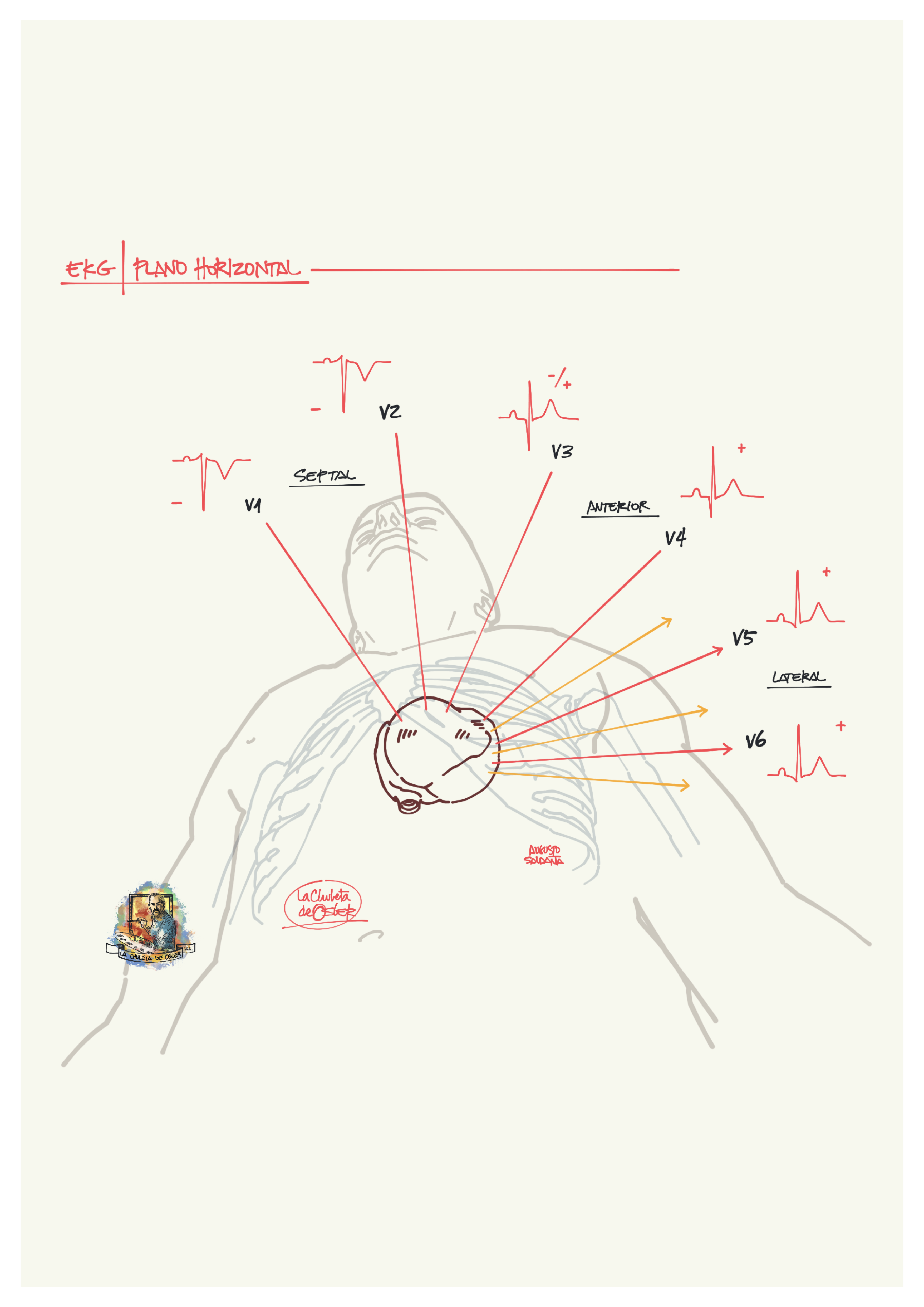 Electrocardiograma (ECG): derivaciones y caras del corazón – La Chuleta ...
